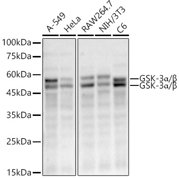 GSK-3α/β Rabbit mAb-单克隆抗体- ABclonal